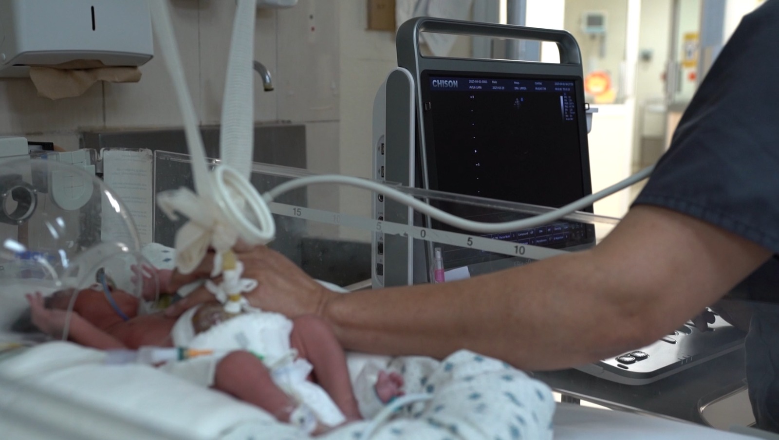 Prematuridad, la principal causa de muerte infantil en México: Bebés ...